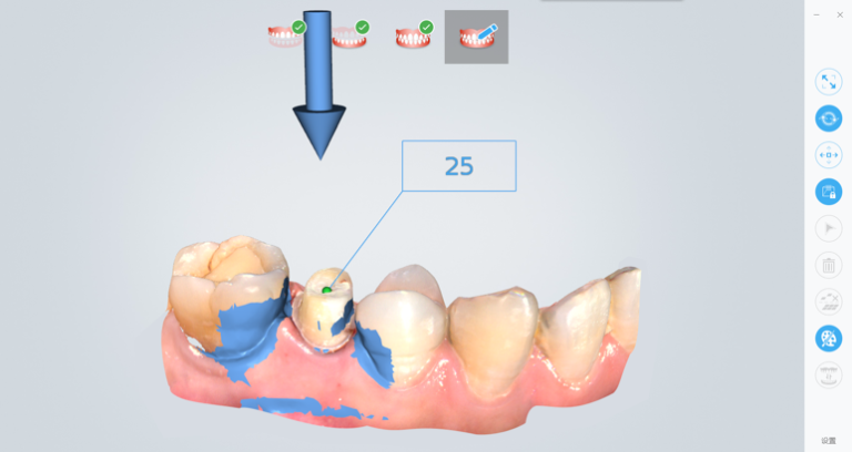 3D Scanner | Digital Dental